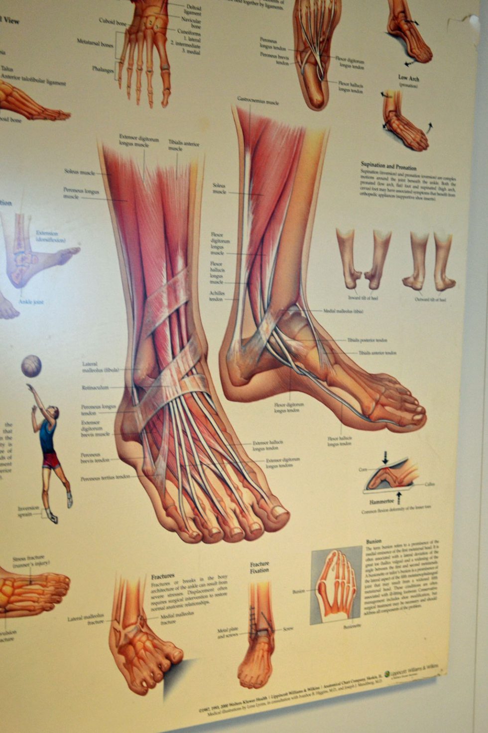 Langdurige voetwonden - Podologiepraktijk Liesbeth D'Hulster